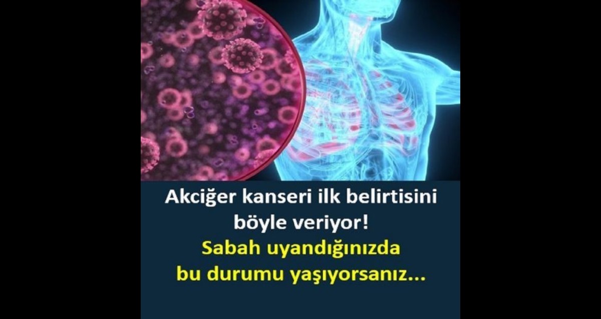 İşte akciğer kanserinin 12 belirtisi.