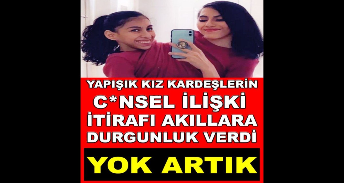 Yapışık kız kardeşlerin c.nsel ilişki itirafı akıllara durgunluk verdi